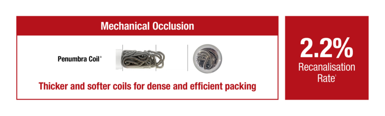 Peripheral Embolisation | Penumbra Inc