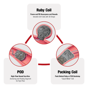 Peripheral Embolisation | Penumbra Inc