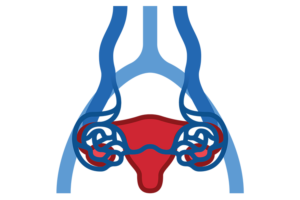 Q&A: Addressing Pelvic Venous Disease with a New Class of Coils ...
